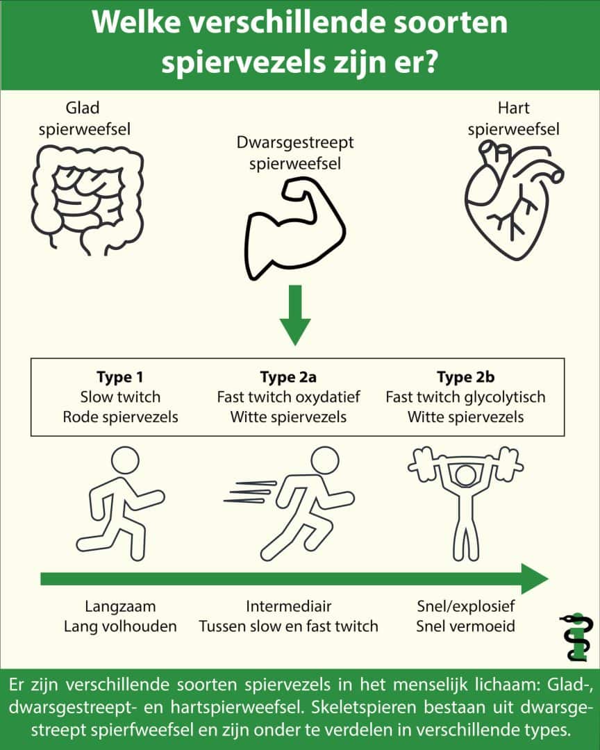 Welke soorten spiervezels zijn er? | Medicus Online